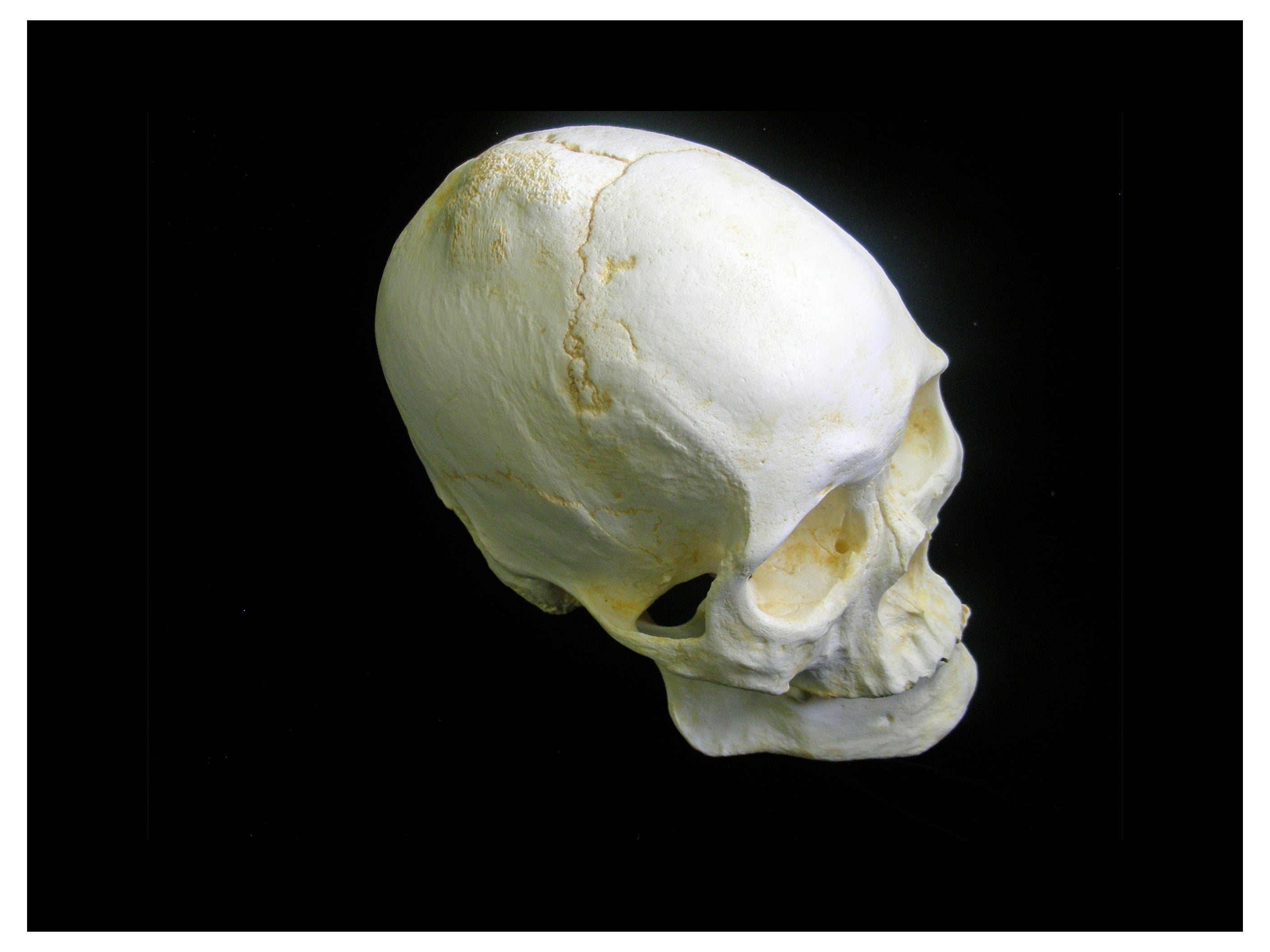 Mongoloid 633P Male Skull | My Site
